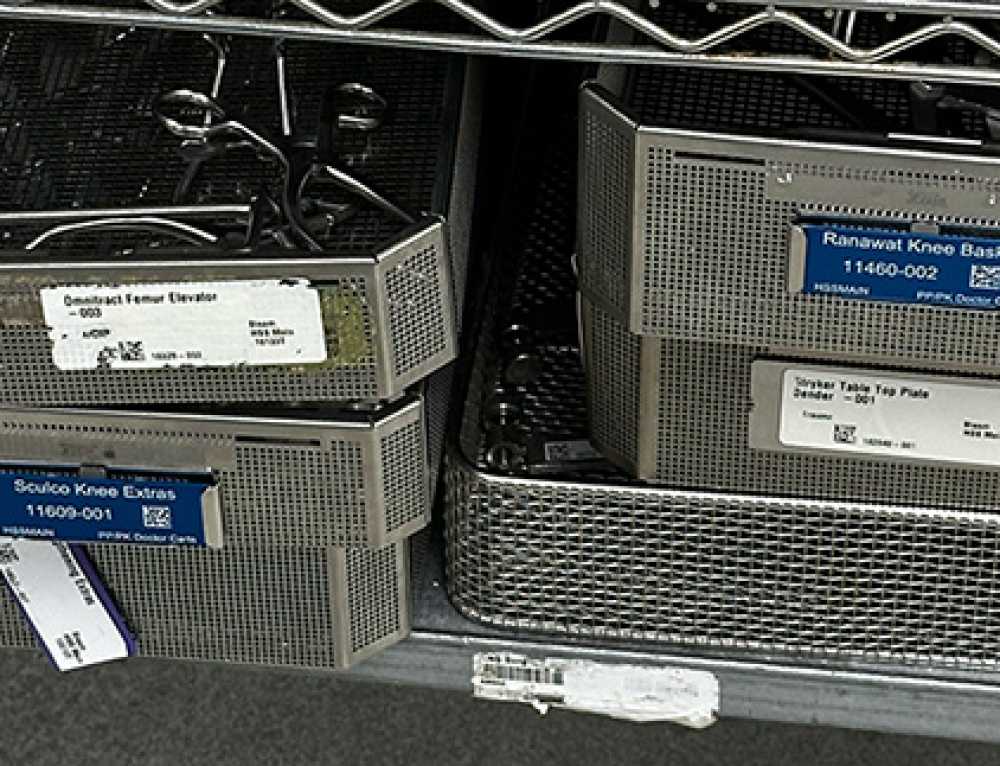 5 Benefits of Controlled Irrigation in Stone Surgery