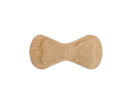 Euphoric Results with Sheehy Collar Button Ear Tubes