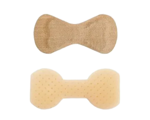 Euphoric Results with Sheehy Collar Button Ear Tubes